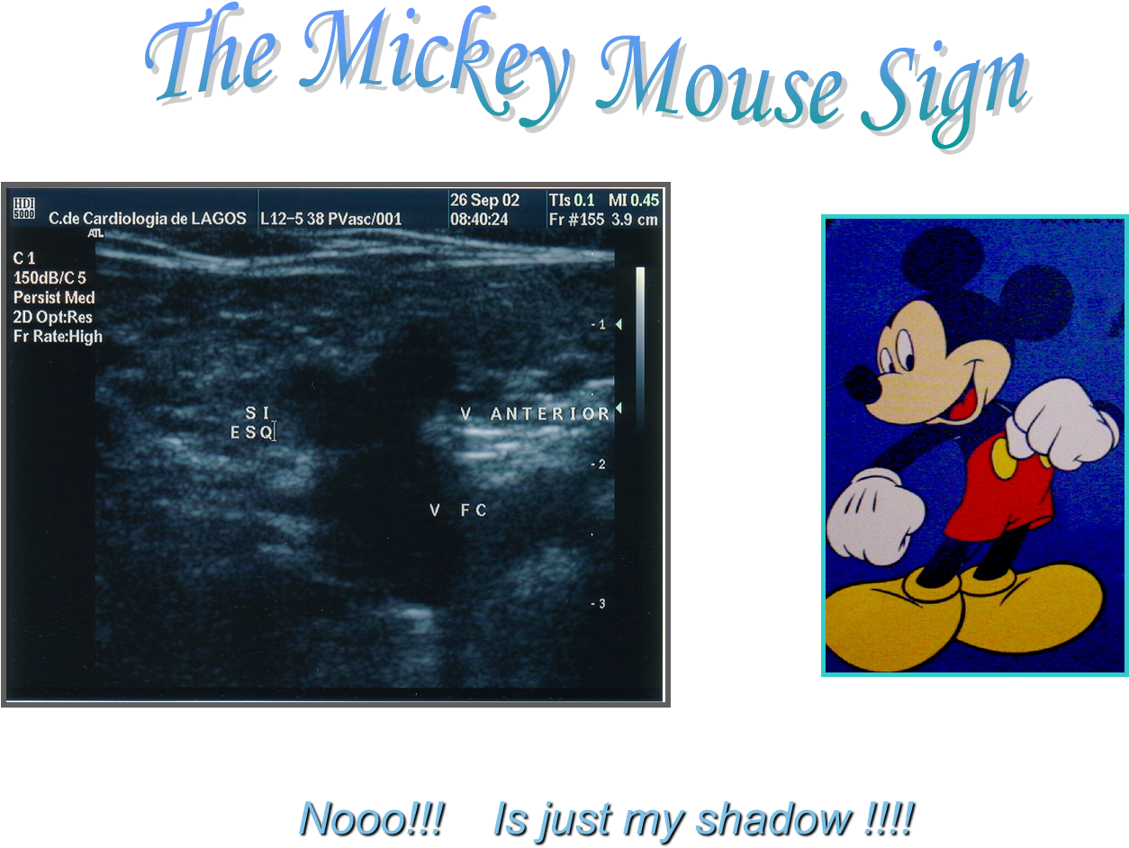 Download Mickey Mouse Sign - Mickey Mouse PNG Image with No Background ...