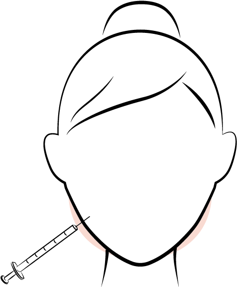 Download What Is Botulinum Toxin Type A (botox) - Line Art PNG Image ...