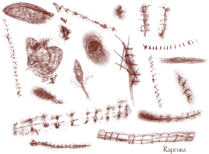 Wounds And Stitches By Raptura Stitches Png - Stitches - Free Transparent PNG Download - PNGkey