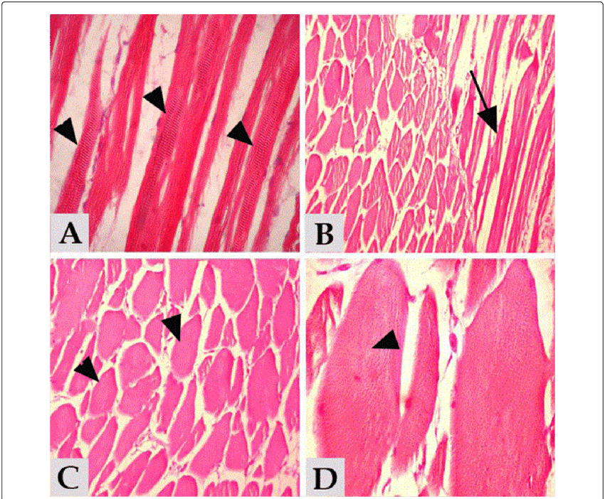 Download 2 And 3 Showing Normal, Intact Skeletal Muscle With - Muscle ...
