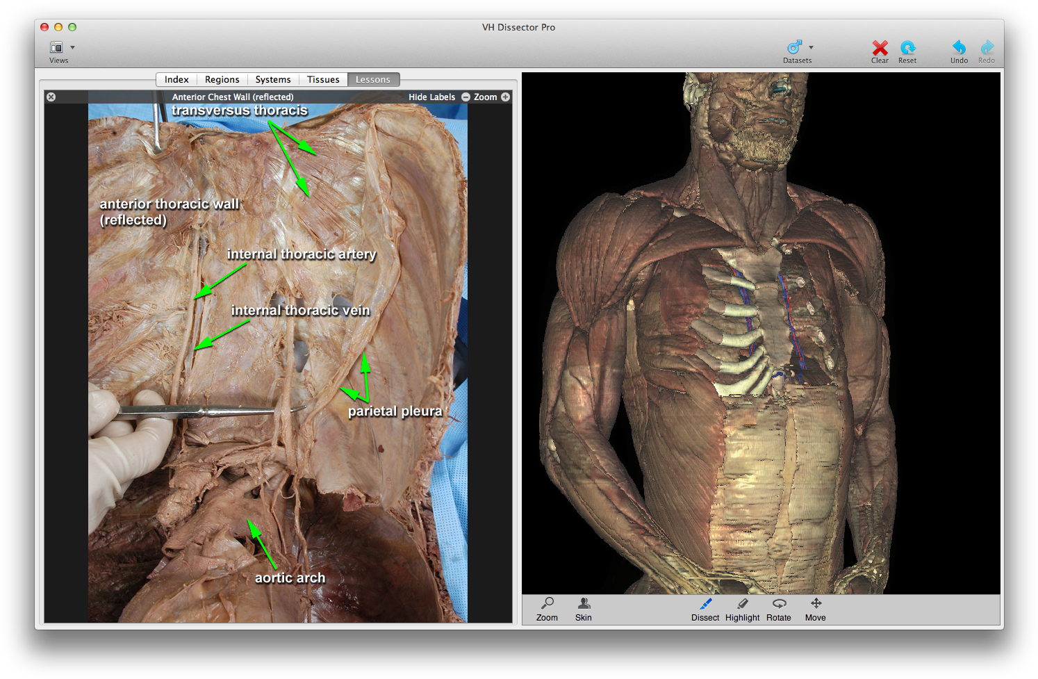 Download Step By Step Dissection Instructions - Anatomy PNG Image with ...