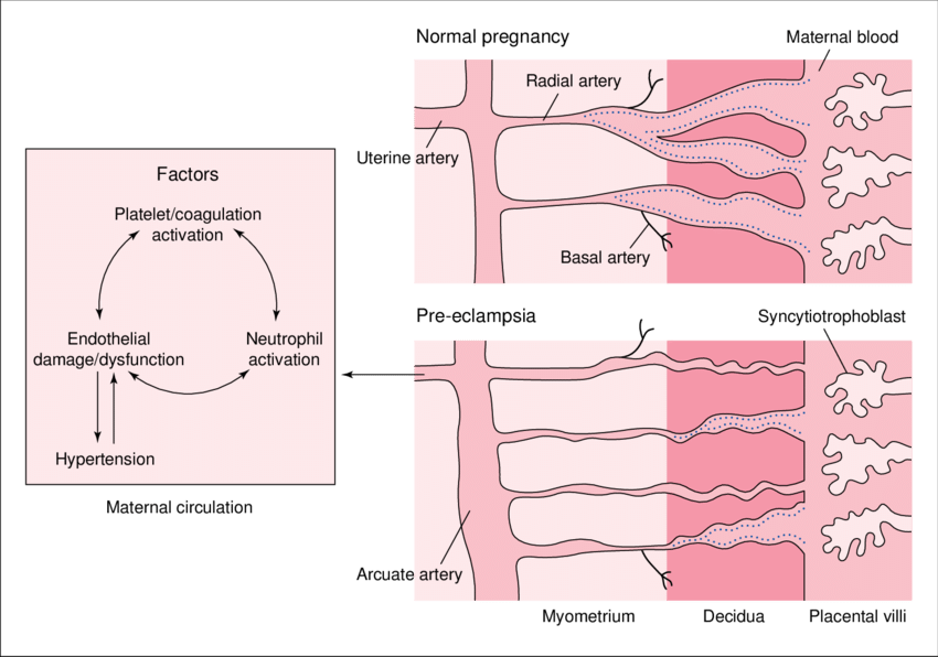 Download Schematic Representation Of Trophoblast Invasion Of ...