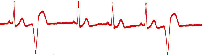 Ekg Line Png Dr - Ekg Transparent - Free Transparent PNG Download - PNGkey