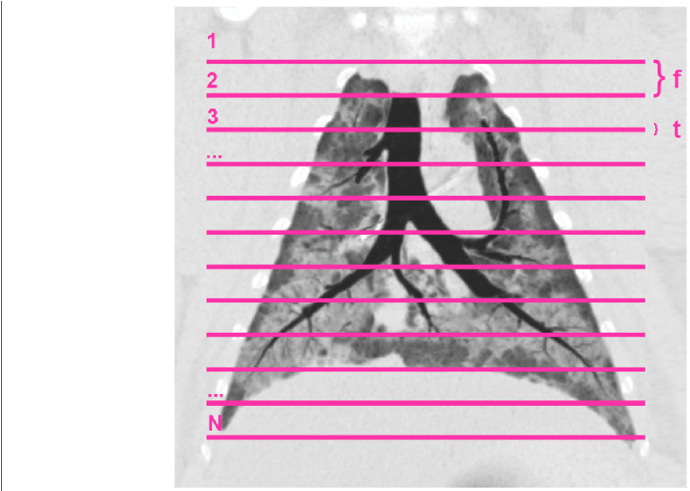 Download Coronal Plane Reconstruction Of A Representative Animal ...