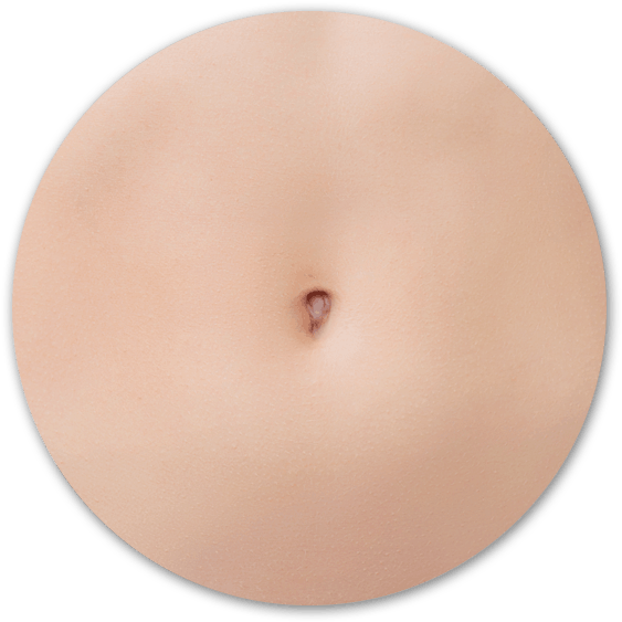 Download Belly Button Surgery Surrey - Umbilicoplasty PNG Image with No ...