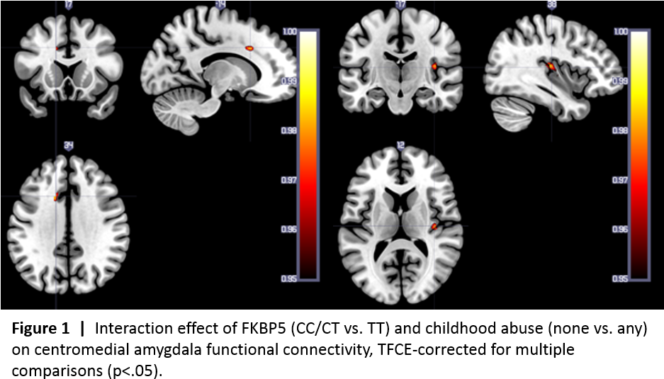 Download Figure1 PNG Image with No Background - PNGkey.com