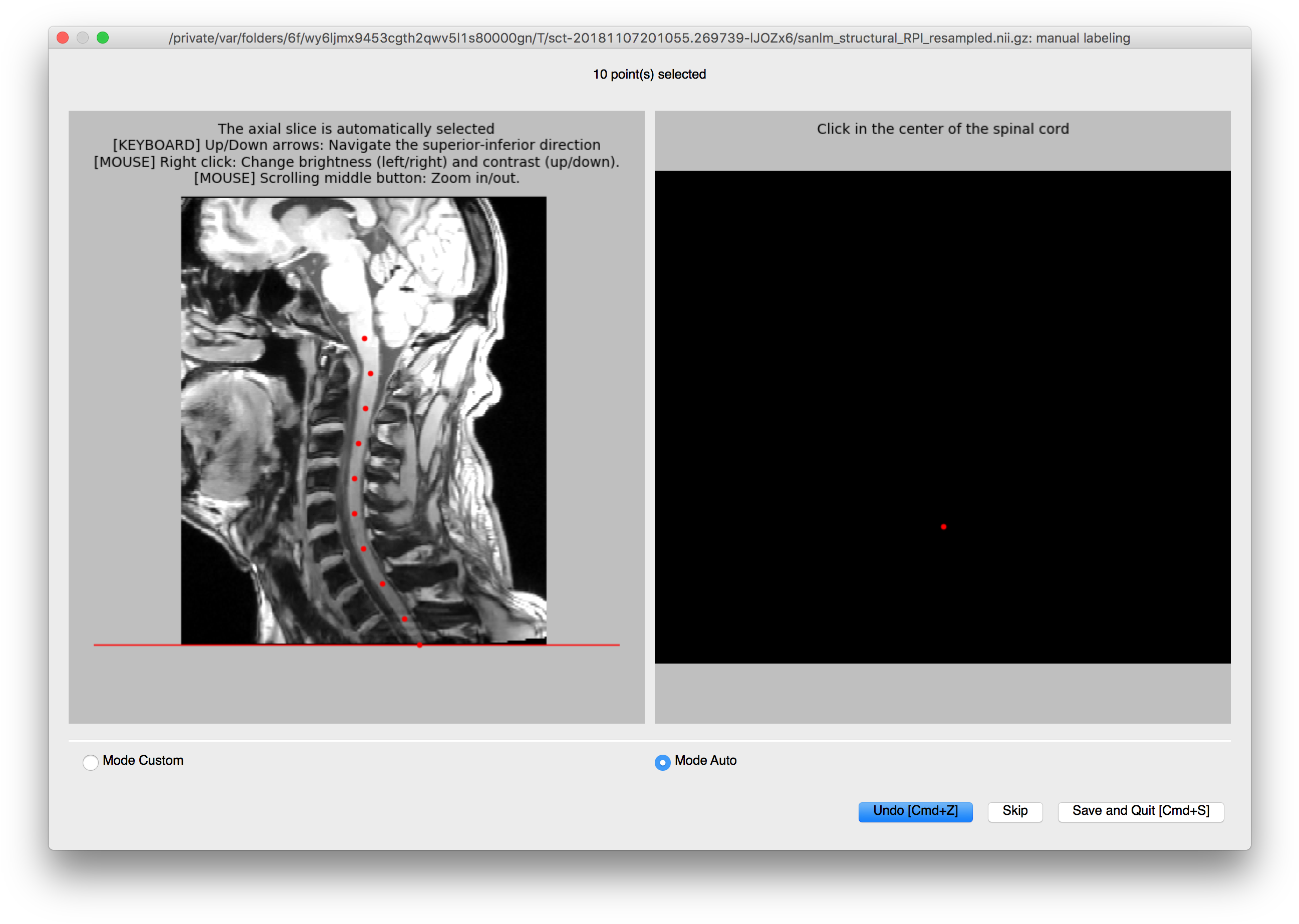Centerline-viewer - Free Transparent PNG Download - PNGkey
