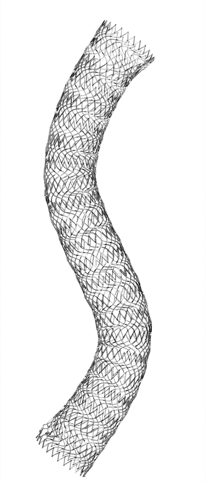 Vici Venous Stent® - Free Transparent PNG Download - PNGkey