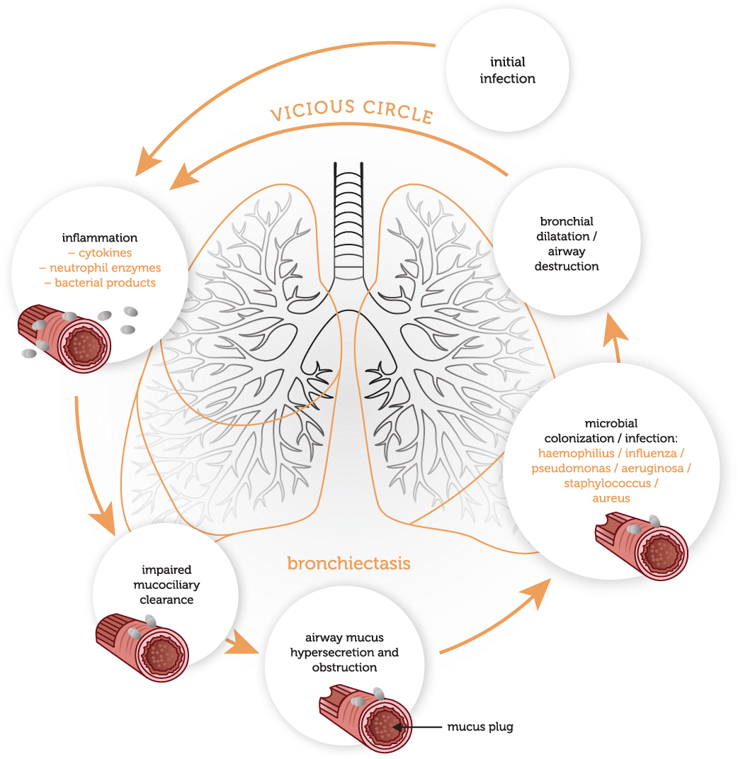 Pathophysiology - Free Transparent PNG Download - PNGkey