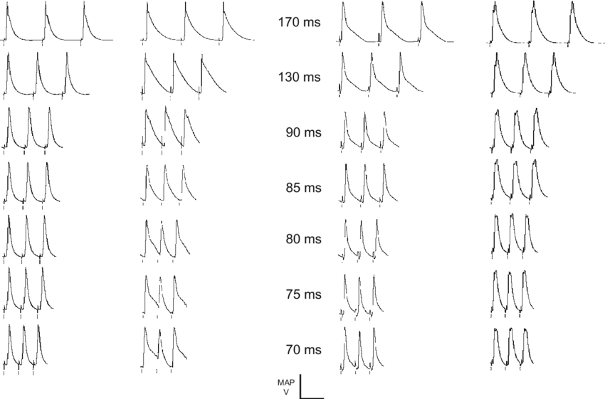 Download Epicardial Monophasic Action Potential Recordings Obtained PNG ...