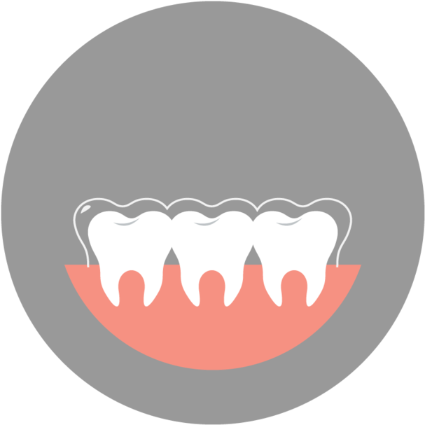 Download Invisalign-art - Illustration PNG Image with No Background ...
