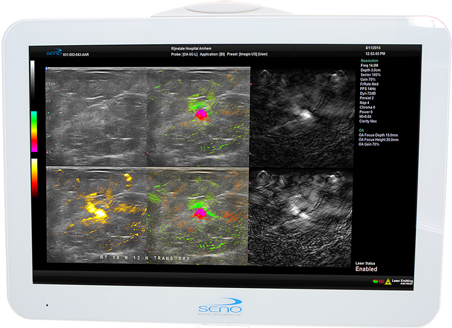 Download Monitor-950w - Seno Medical PNG Image with No Background ...