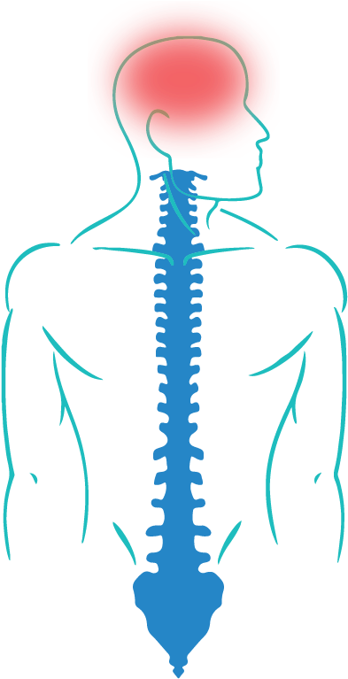 Download Headaches & Tmj Disorder - Skeleton PNG Image with No ...