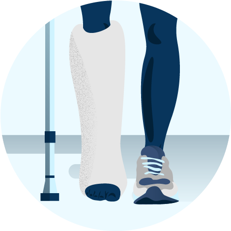 Download Illustration Of A Person's Leg In A Cast - Illustration PNG ...