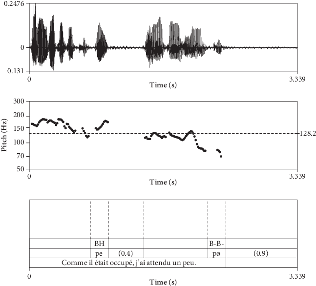 Prototypical Marking Of A Comma - Diagram - Free Transparent PNG ...